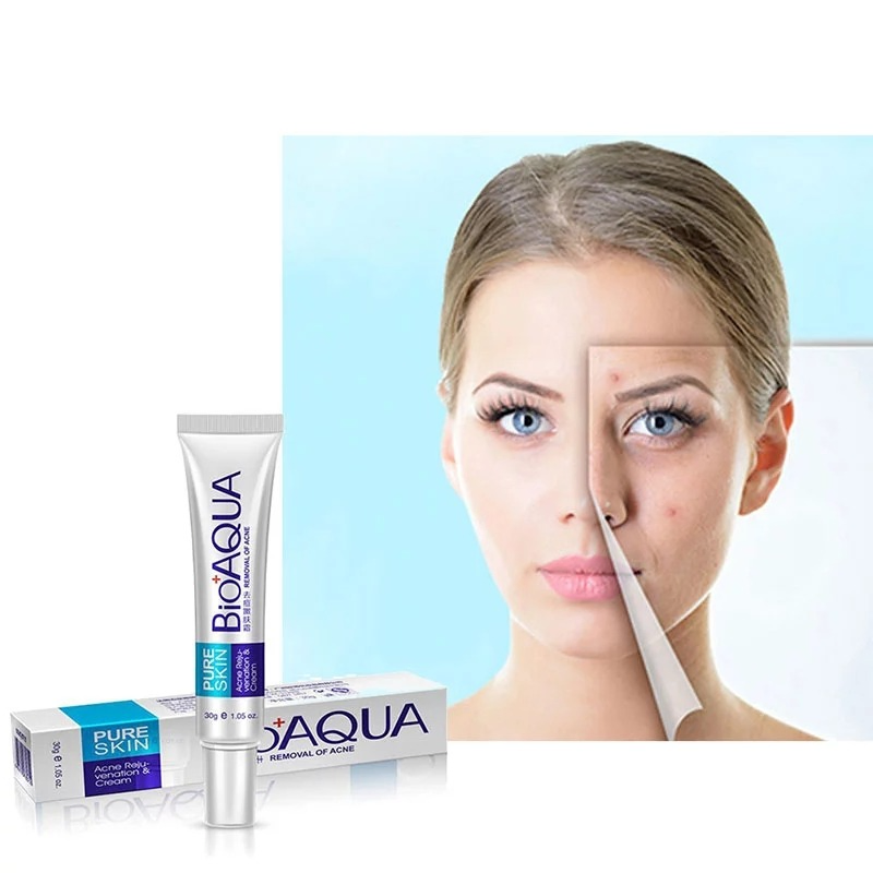 BIOAQUA Acne Treatment Cream - Only 99 Shop